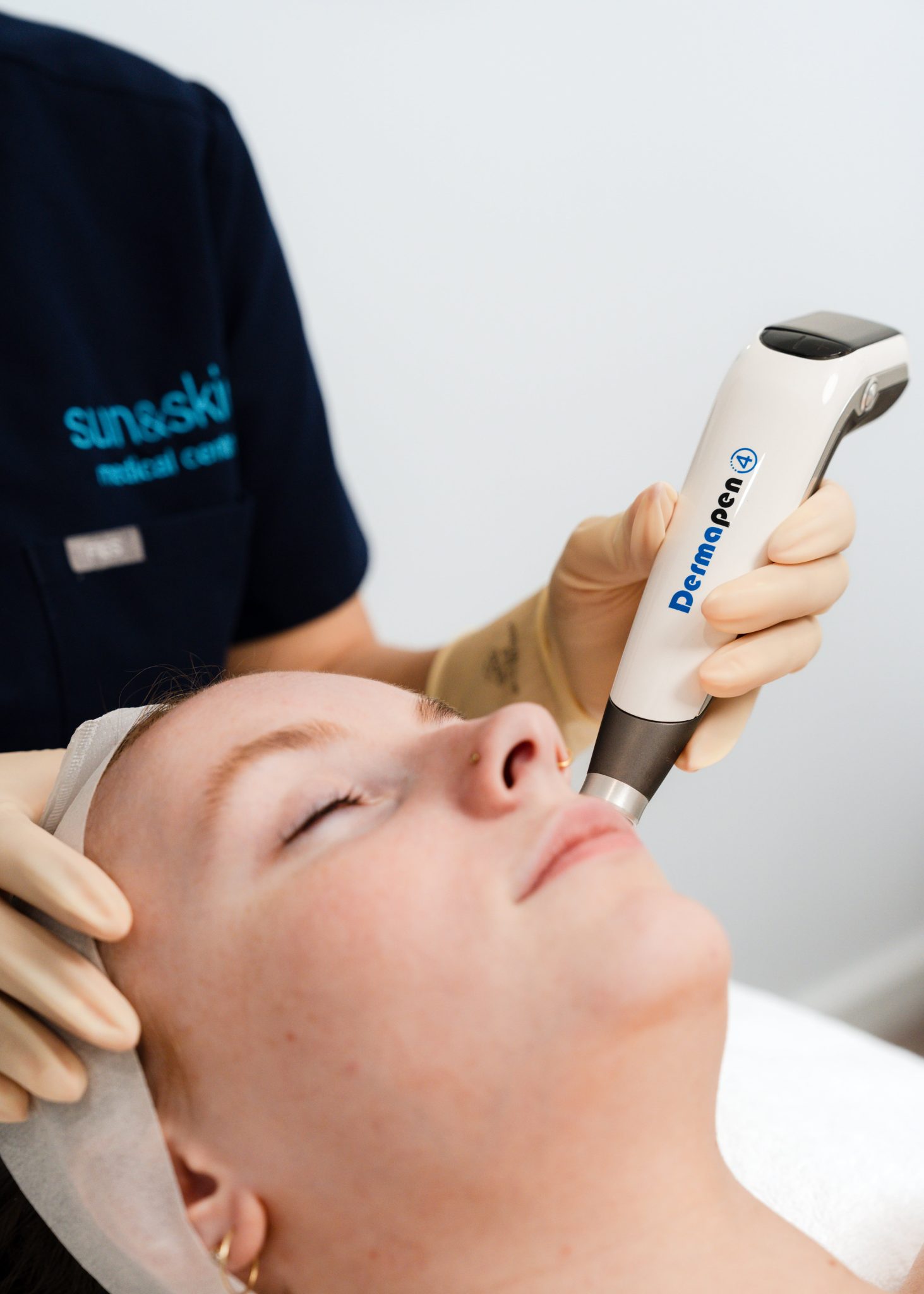 Skin Microneedling | Best in Mount Eliza Melbourne